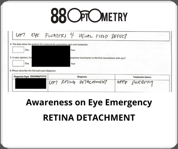 Seeing A Lot of Black Things In Your Vision & Flashes of Light? – 88 ...
